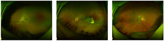 A Teleophthalmology Support System Based on the Visibility of Retinal ...