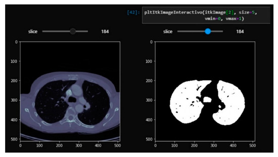 Sensors | Free Full-Text | Nextmed: Automatic Imaging Segmentation, 3D ...