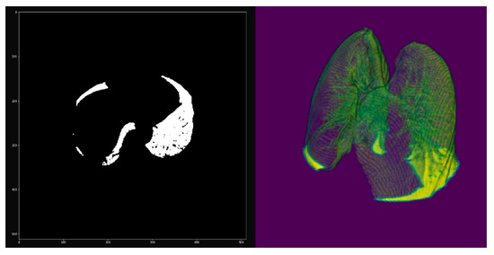Nextmed: Automatic Imaging Segmentation, 3D Reconstruction, and 3D ...