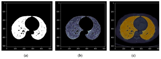 Sensors | Free Full-Text | Nextmed: Automatic Imaging Segmentation, 3D ...