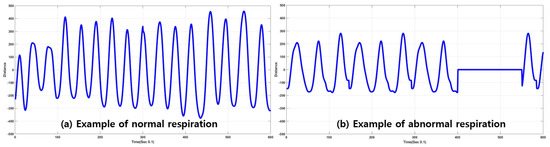 Detection of Abnormal Respiration from Multiple-Input Respiratory Signals