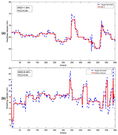 Remote Monitoring of Human Vital Signs Based on 77-GHz mm-Wave FMCW Radar
