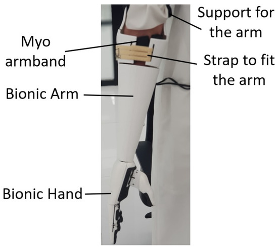 Machine-Learning-Based Muscle Control of a 3D-Printed Bionic Arm