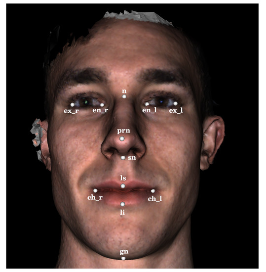 Fully Automatic Landmarking of Syndromic 3D Facial Surface Scans Using ...