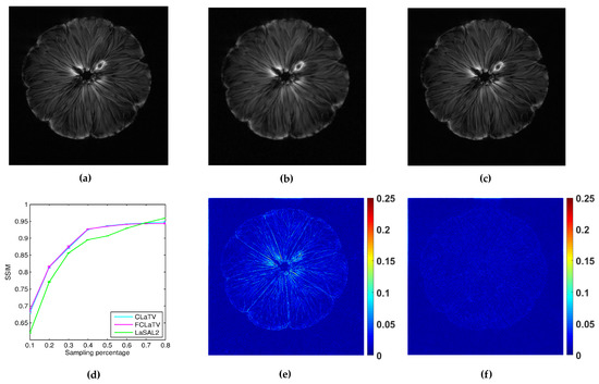 Sensors | Free Full-Text | MRI Reconstruction Using Markov Random Field and Total Variation as ...