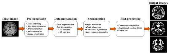 MRI Segmentation and Classification of Human Brain Using Deep Learning ...