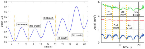 Fiber-Optic Based Smart Textiles for Real-Time Monitoring of Breathing Rate