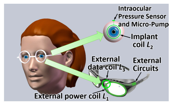 Wireless Power Transfer Techniques for Implantable Medical Devices: A ...