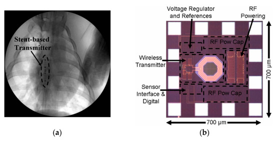 Wireless Power Transfer Techniques for Implantable Medical Devices: A ...