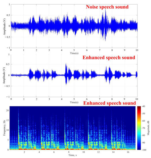 Sensors | Free Full-Text | A Real-Time Speech Separation Method Based on Camera and Microphone ...