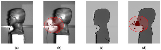 Real-Time Interference Artifacts Suppression in Array of ToF Sensors