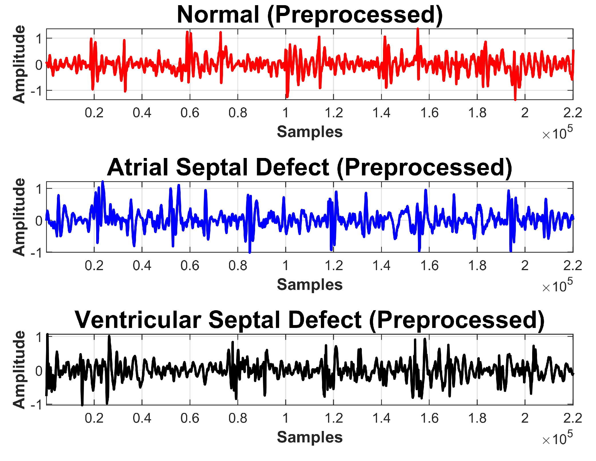 Sensors | Free Full-Text | Phonocardiogram Signal Processing for Automatic Diagnosis of ...