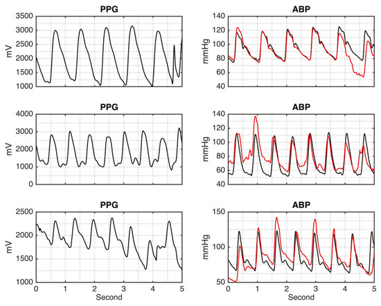 Sensors | Special Issue : Advanced Signal Processing in Wearable ...