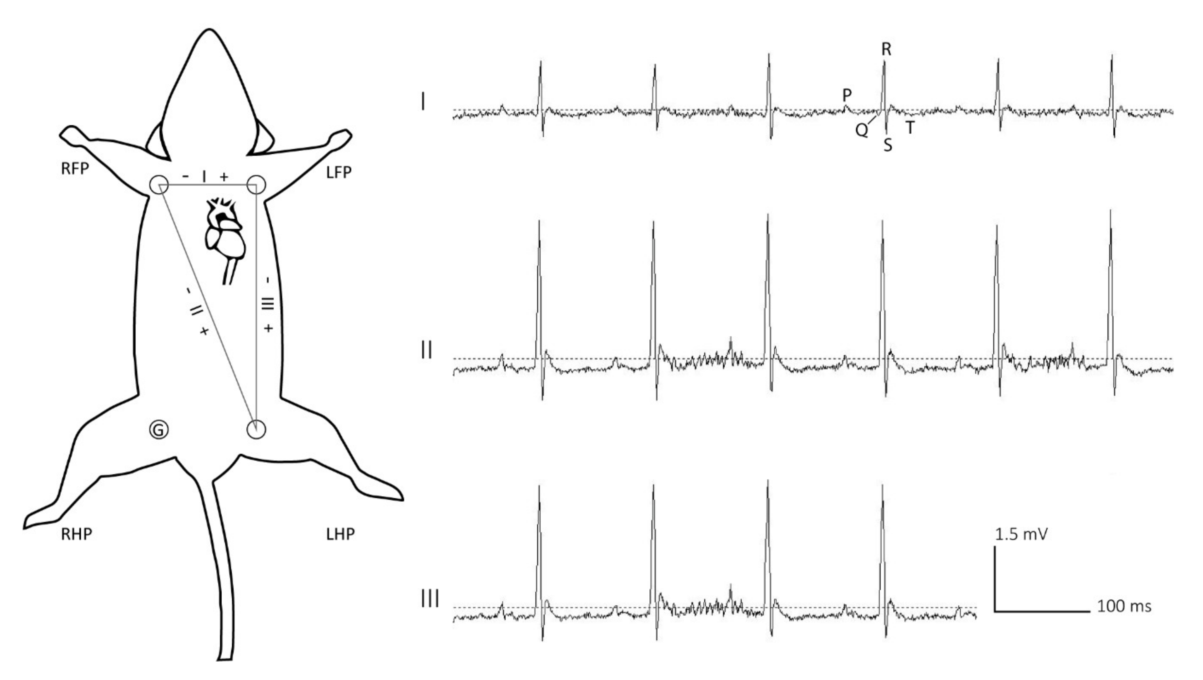 Sensors Free Full Text Ambulatory Electrocardiographic Monitoring