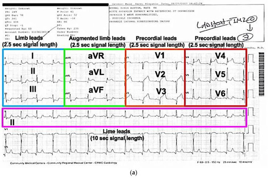 Sensors | Free Full-Text | A Dynamic Systems Approach for Detecting and ...