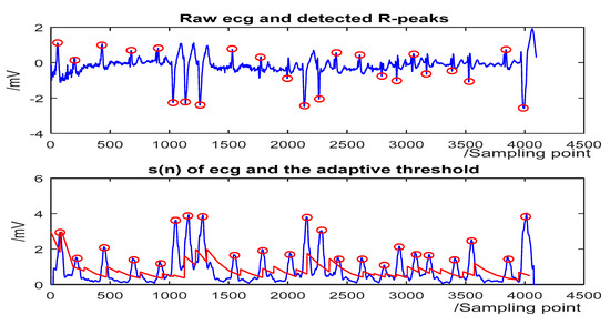 A Real Time QRS Detection Algorithm Based on ET and PD Controlled Threshold Strategy