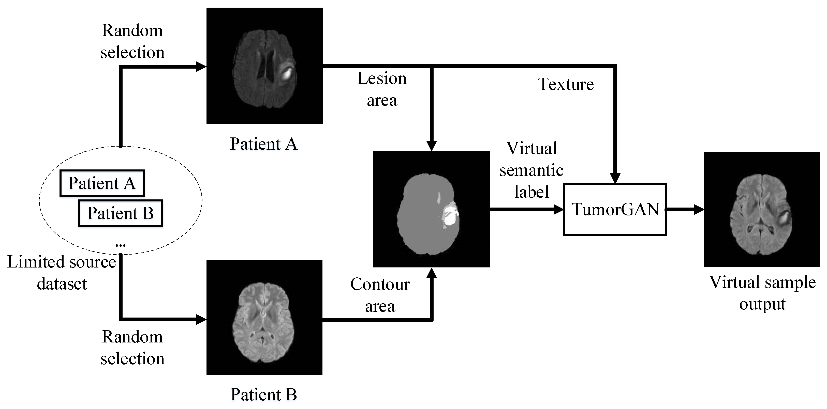 TumorGAN: A Multi-Modal Data Augmentation Framework for Brain Tumor Segmentation