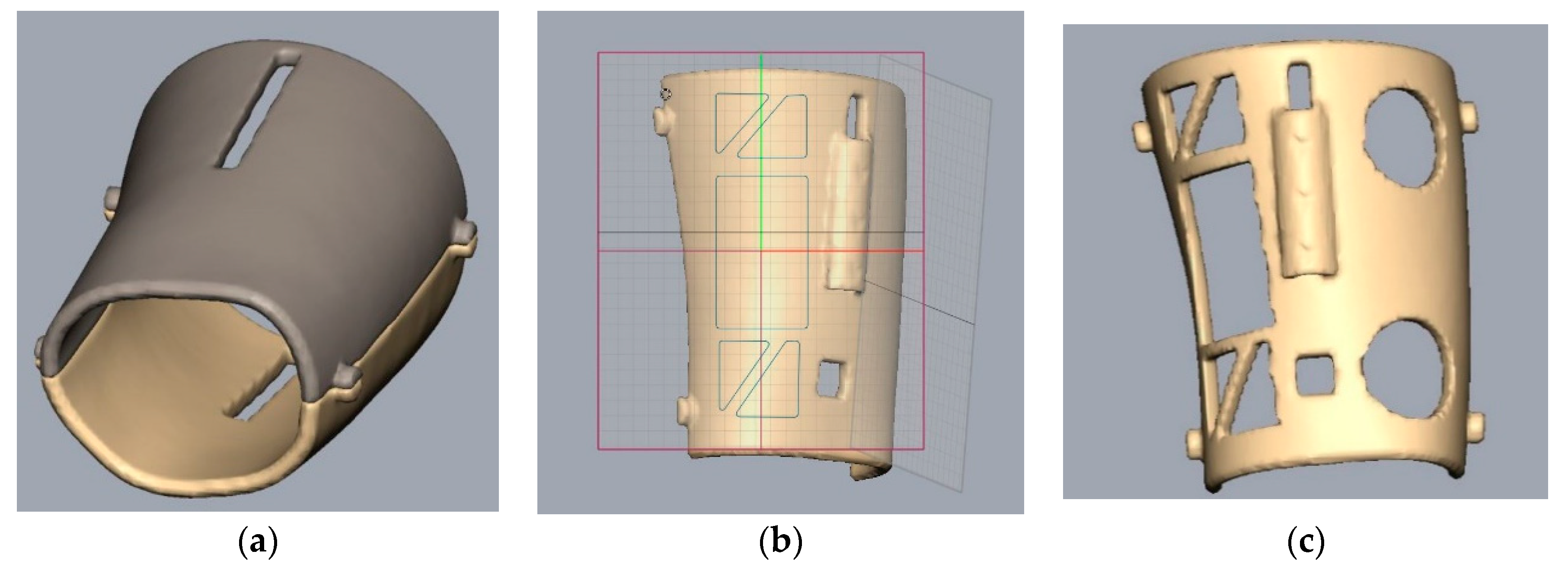 Development of a Smart Splint to Monitor Different Parameters during ...
