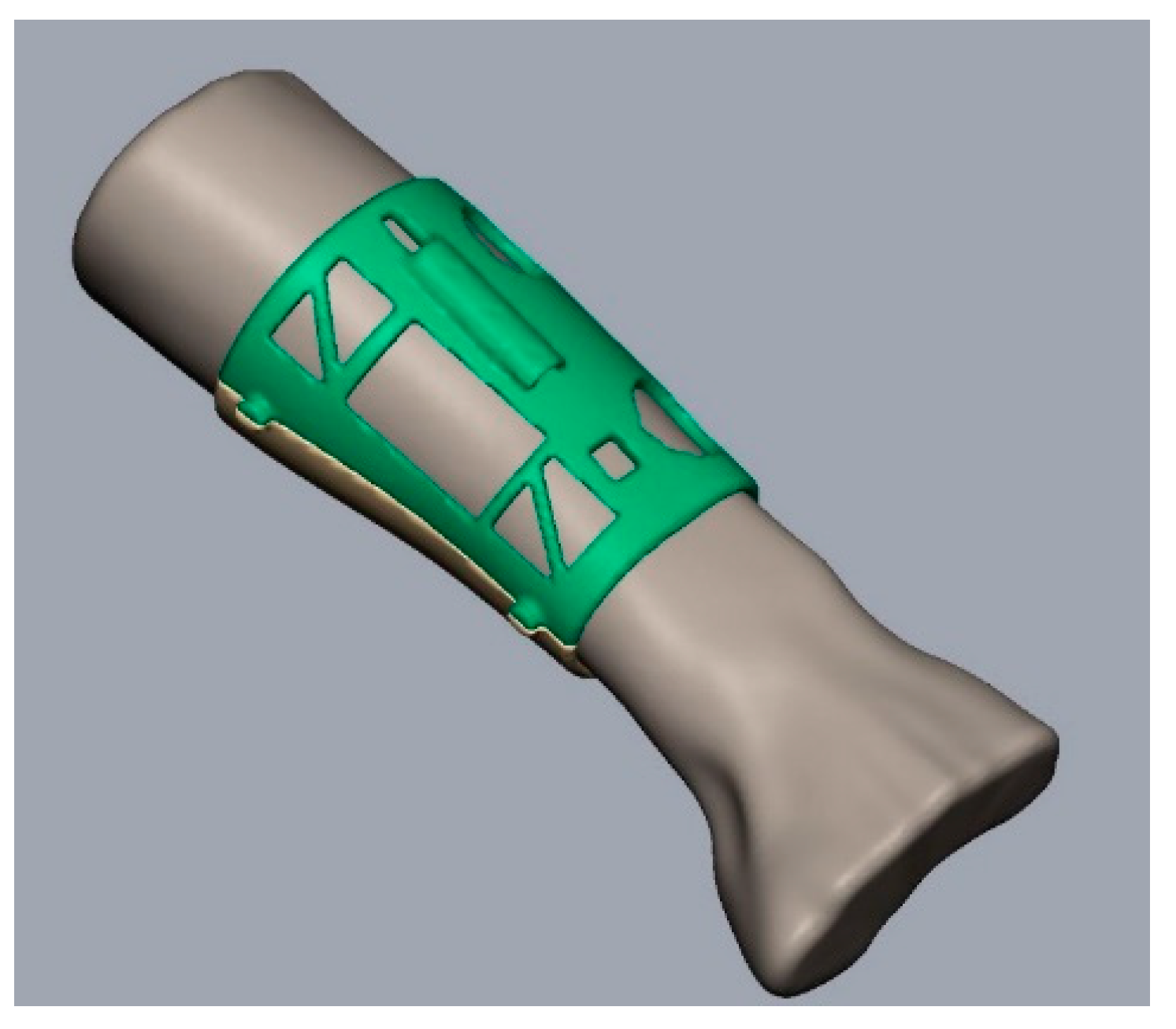 Development of a Smart Splint to Monitor Different Parameters during ...