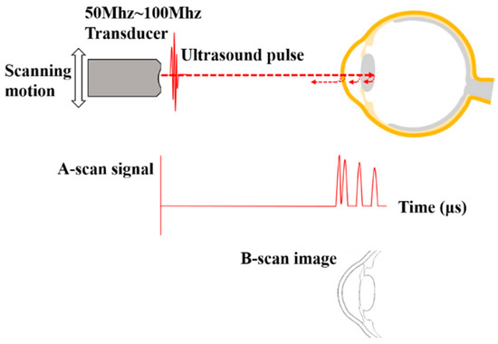 Biometric Measurement of Anterior Segment: A Review