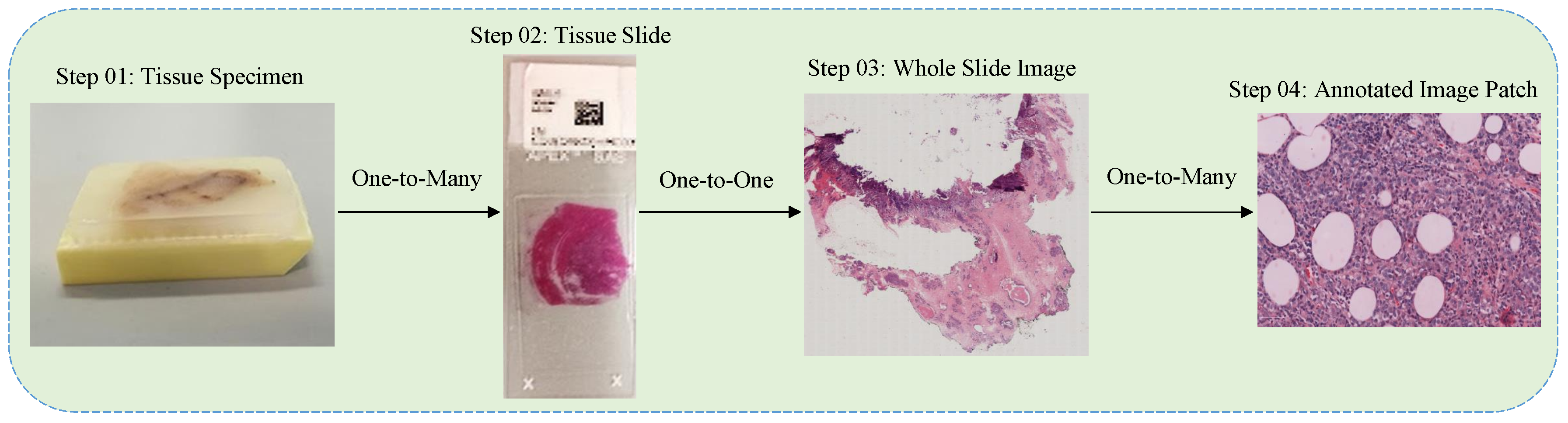 Breast Cancer Histopathology Image Classification Using an Ensemble of ...