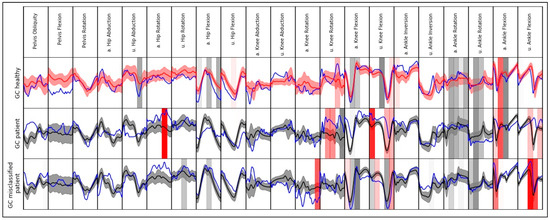 Interpretability of Input Representations for Gait Classification in Patients after Total Hip ...