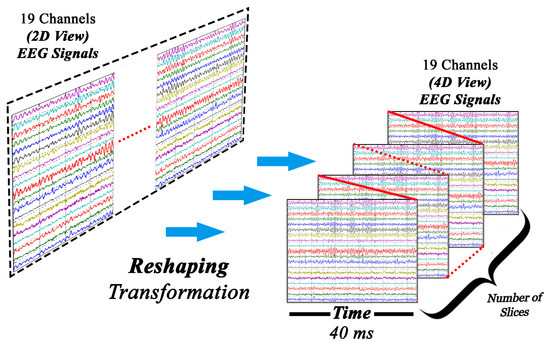 Real-Time Stress Assessment Using Sliding Window Based Convolutional ...