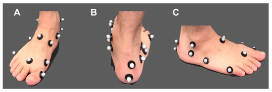 Evaluation of the Validity, Reliability, and Kinematic Characteristics ...