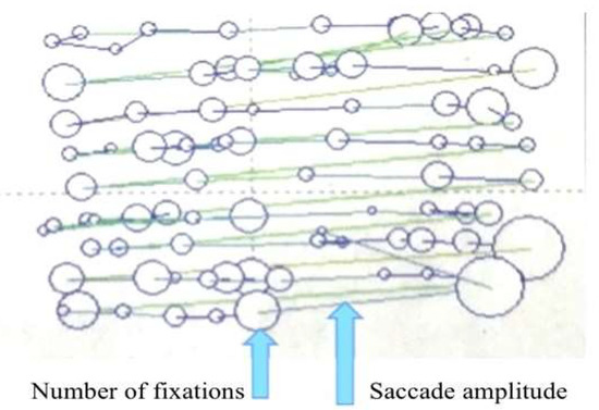 Mind Mapping Training’s Effects on Reading Ability: Detection Based on ...
