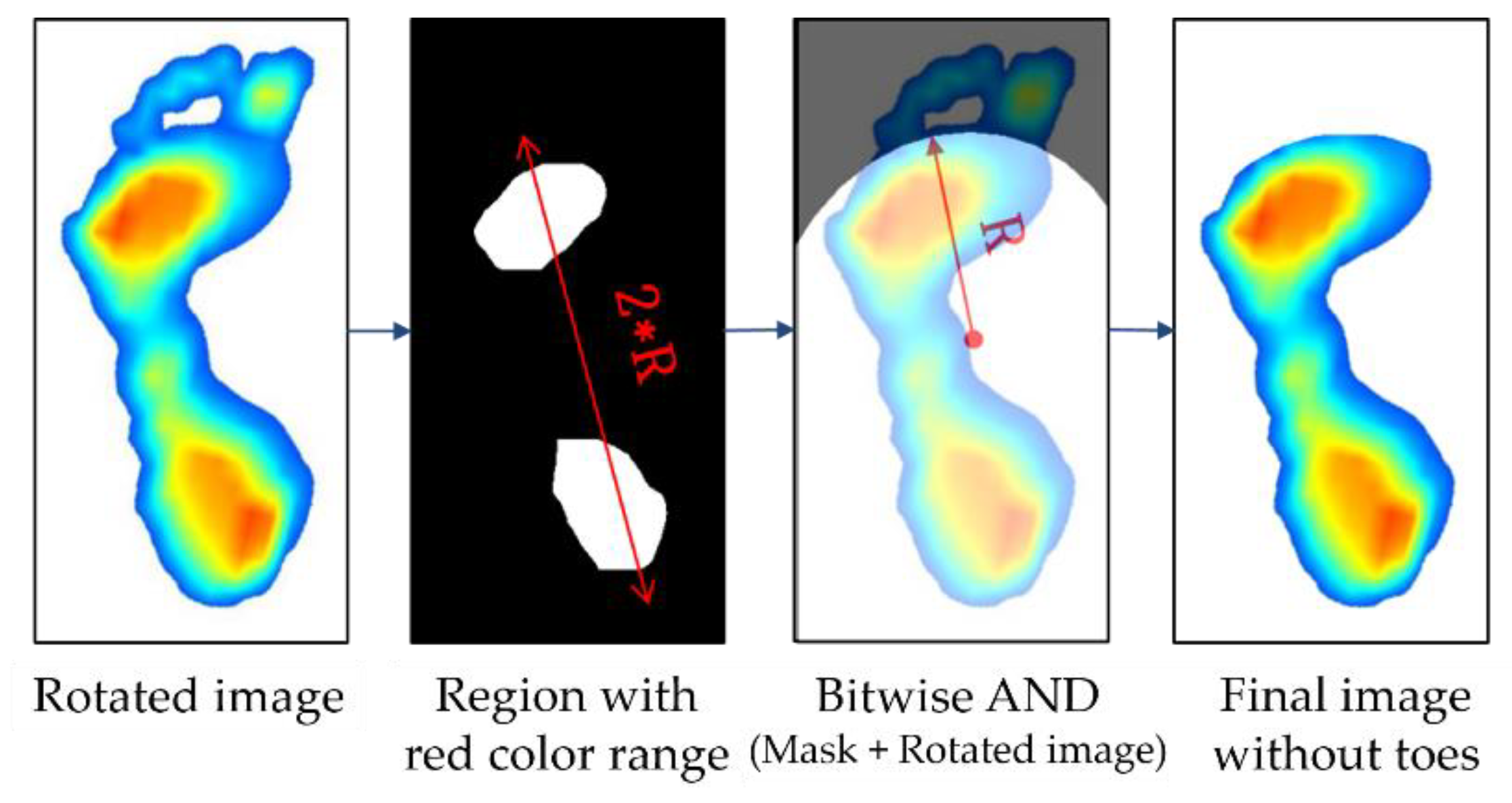 A Deep-Learning Approach for Foot-Type Classification Using ...