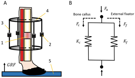 Real-Time Wireless Platform for In Vivo Monitoring of Bone Regeneration