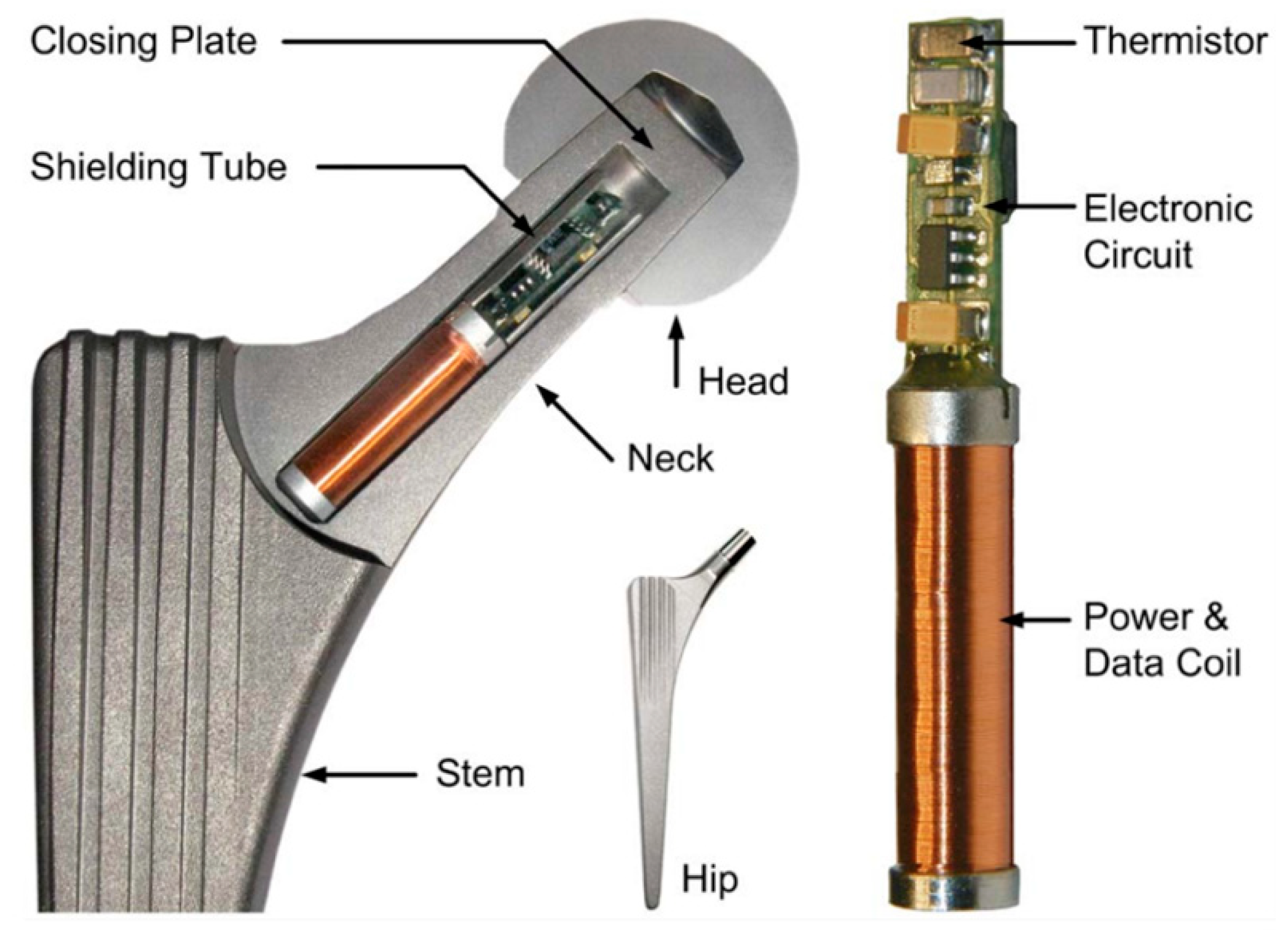 Sensors Free Full Text Wireless Technologies For Implantable Devices