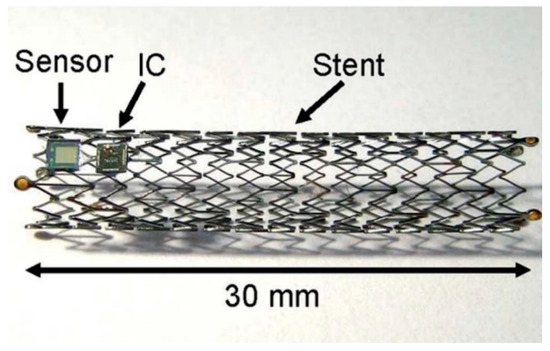 Sensors | Free Full-Text | Wireless Technologies for Implantable Devices