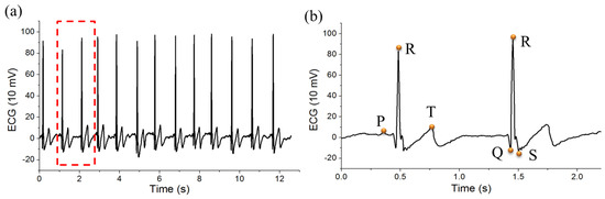 Wearable Physiological Monitoring System Based on Electrocardiography ...