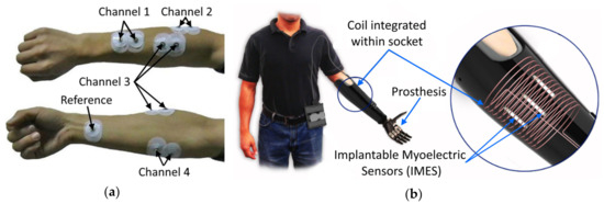 Sensors | Free Full-Text | Control Methods for Transradial Prostheses ...