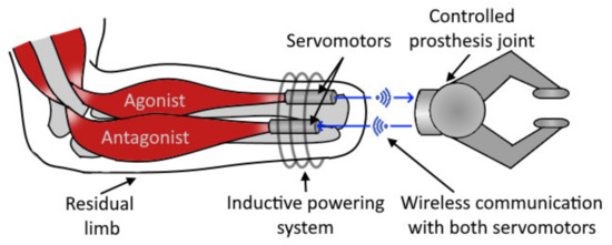 Sensors | Free Full-Text | Control Methods for Transradial Prostheses ...