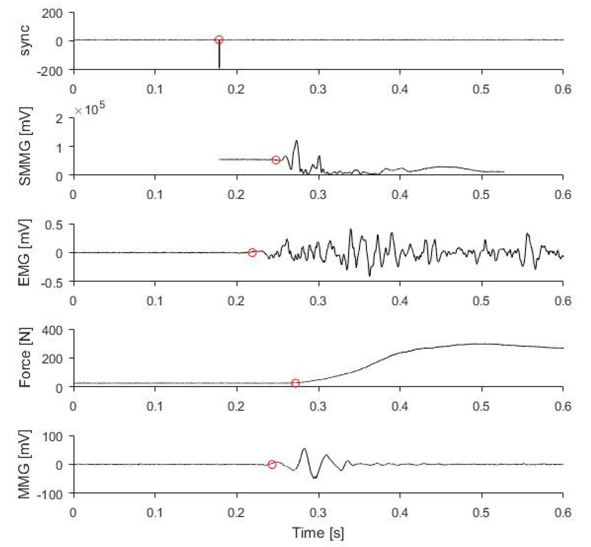 Sonomechanomyography (SMMG): Mapping of Skeletal Muscle Motion Onset ...