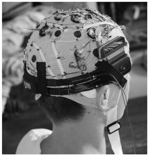 Sensors | Special Issue : Novel Approaches to EEG Signal Processing