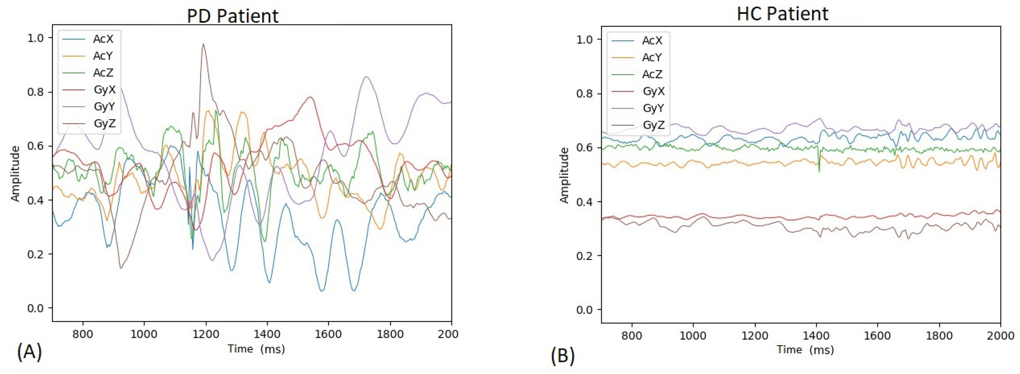 Intelligent Sensory Pen for Aiding in the Diagnosis of Parkinson’s ...