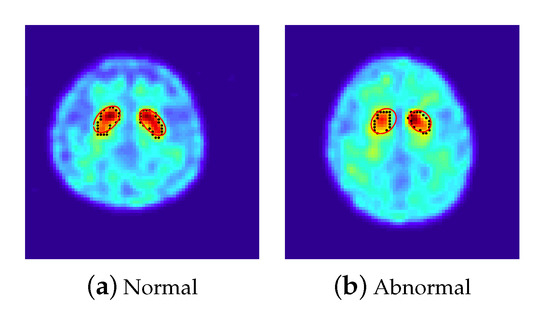 A Shape Approximation for Medical Imaging Data