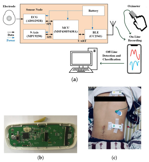 Portable Sleep Apnea Syndrome Screening and Event Detection Using Long ...