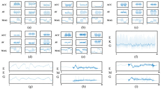 A Multi-Sensor Wearable System for the Quantitative Assessment of ...