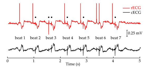 Sensors | Free Full-Text | Car Seats with Capacitive ECG Electrodes Can ...