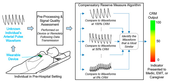 Wearable Sensors Incorporating Compensatory Reserve Measurement for ...