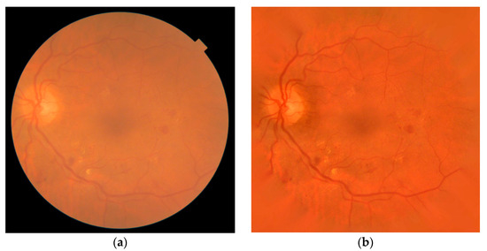 Sensors | Free Full-Text | Effective Fundus Image Decomposition for the ...