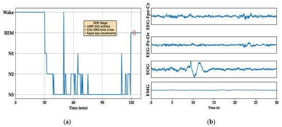Multi-Branch Convolutional Neural Network for Automatic Sleep Stage ...