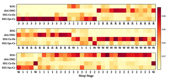 Multi-Branch Convolutional Neural Network for Automatic Sleep Stage ...