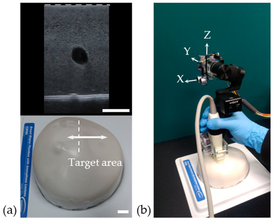 Versatile Low-Cost Volumetric 3D Ultrasound Imaging Using Gimbal ...
