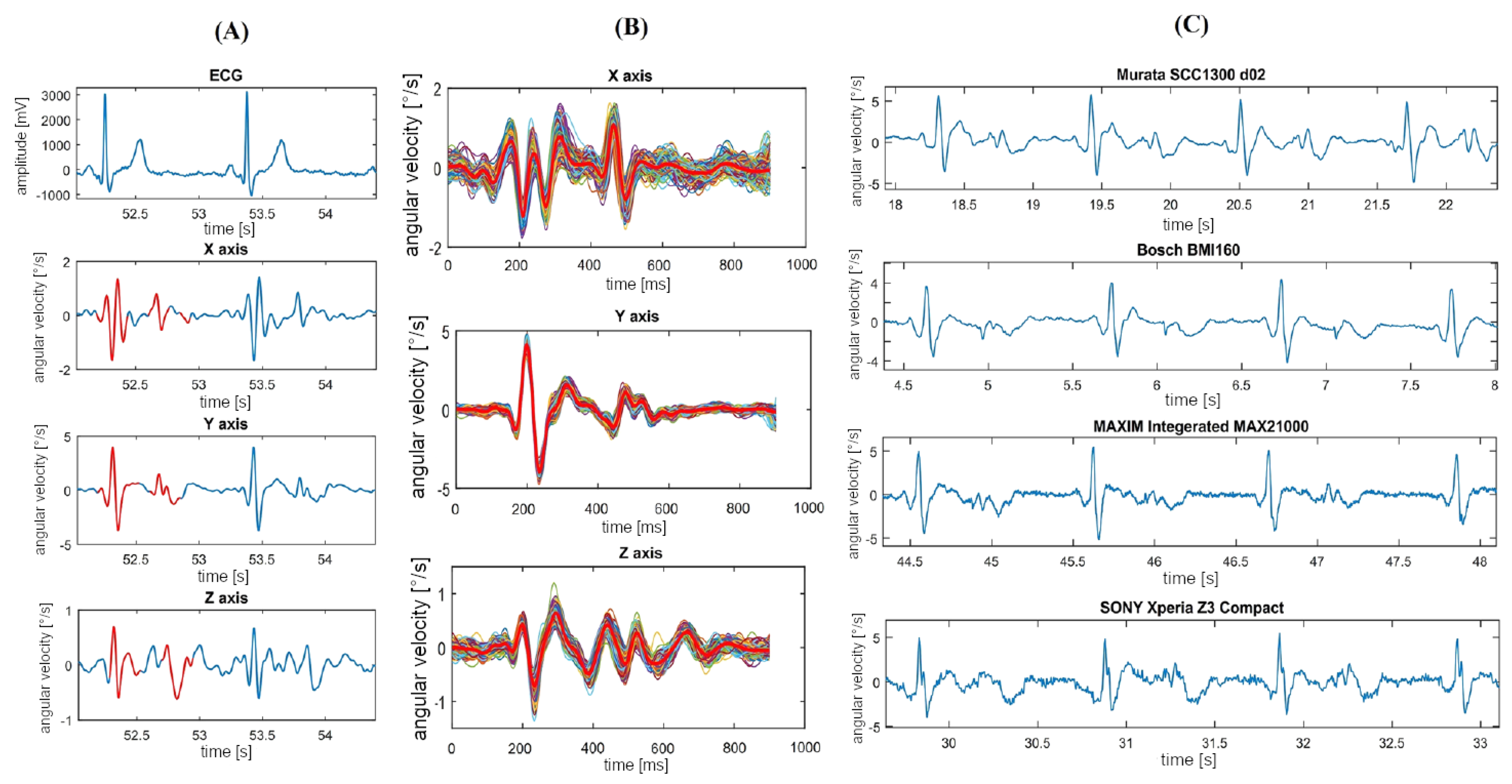 Gyrocardiography: A Review of the Definition, History, Waveform ...