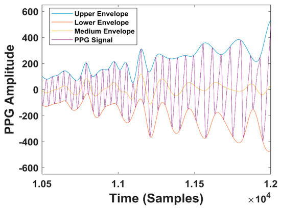 A New Wearable System for Home Sleep Apnea Testing, Screening, and ...